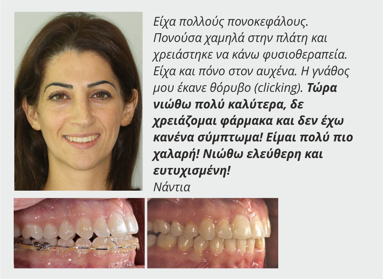 Ορθοδοντική ενηλίκων, Λεμεσός - Kokkinos Smile Center